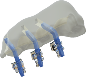 Maestro 3D Dental Studio – Awesome Technology